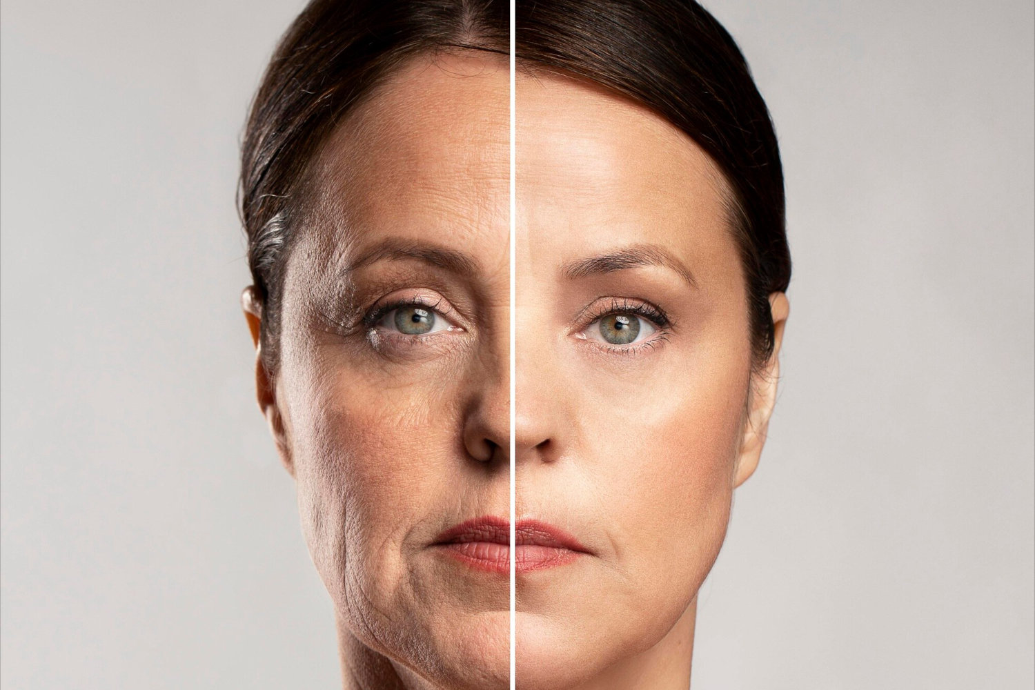 Preenchimento Facial - Dra. Gih Oliveira